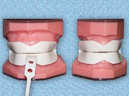 Technical Information about Denta-Gard® Mouthguards